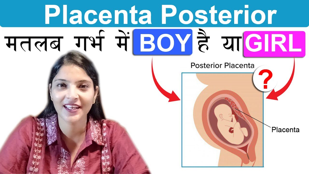 Placenta Posterior means boy or girl।placenta anterior means boy or ...