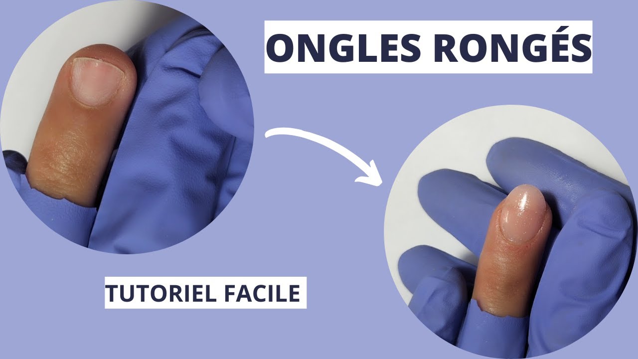Comment faire un RALLONGEMENT au chablon sur ONGLES RONGÉS. - YouTube