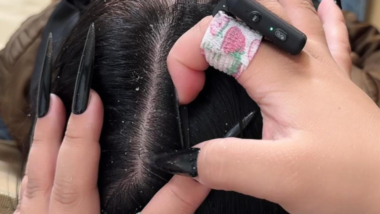 Faye’s ASMR Scalp Therapy — Slow Long-Nail Tracing for Quiet, Deep Calm ...