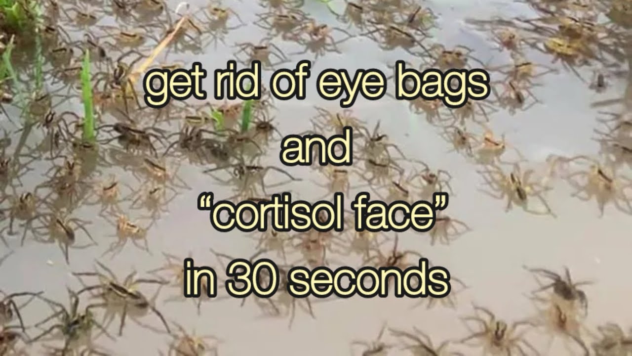 How to Get Rid of Eye Bags, ‘Cortisol Face’ and Headaches in 30 Seconds ...