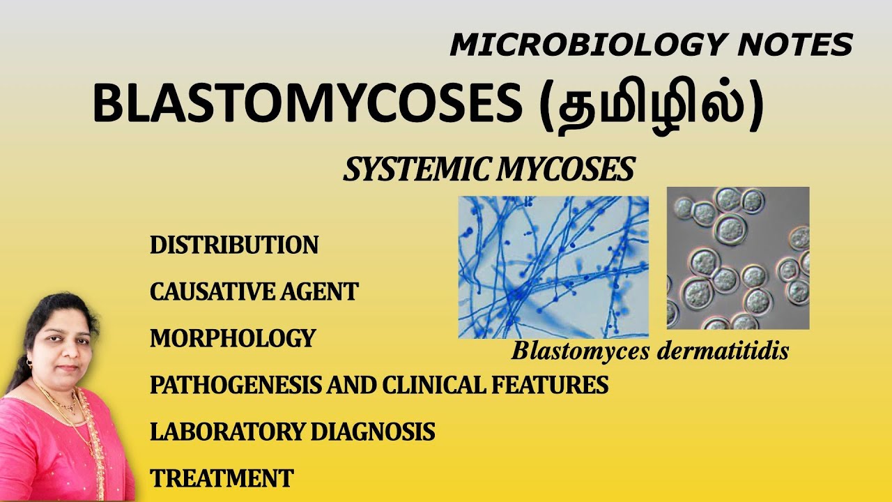 Blastomyces Dermatitidis Blastomycosis—Some Progress But Still Much