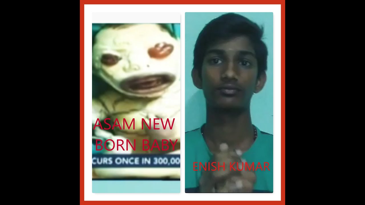 The Assam new Born baby explain by Enish Kumar - YouTube