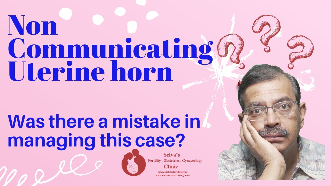 Laparoscopic excision of non communicating uterine horn - YouTube