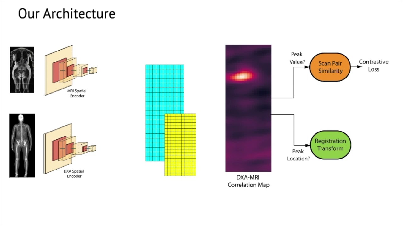 Self-Supervised Multi-Modal Alignment for Whole Body Medical Imaging ...