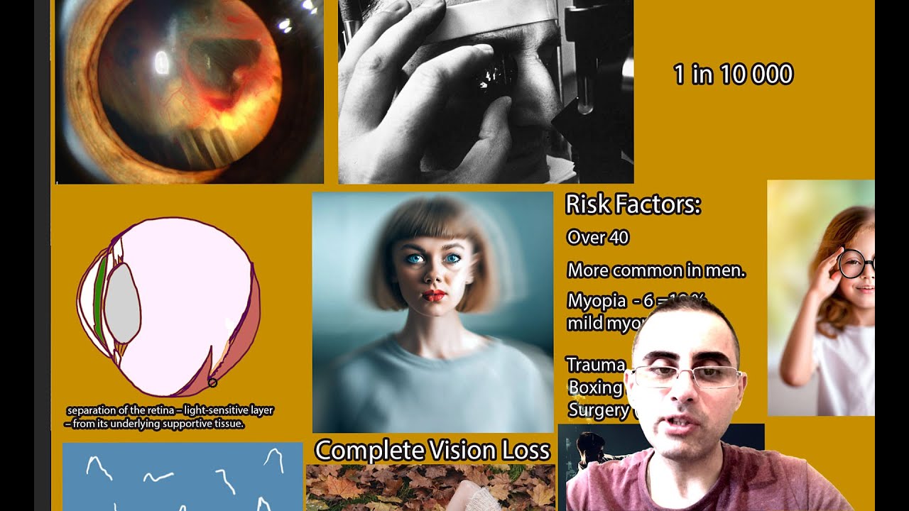 Retinal Detachment symptoms. Alarming disease which can cause permanent ...