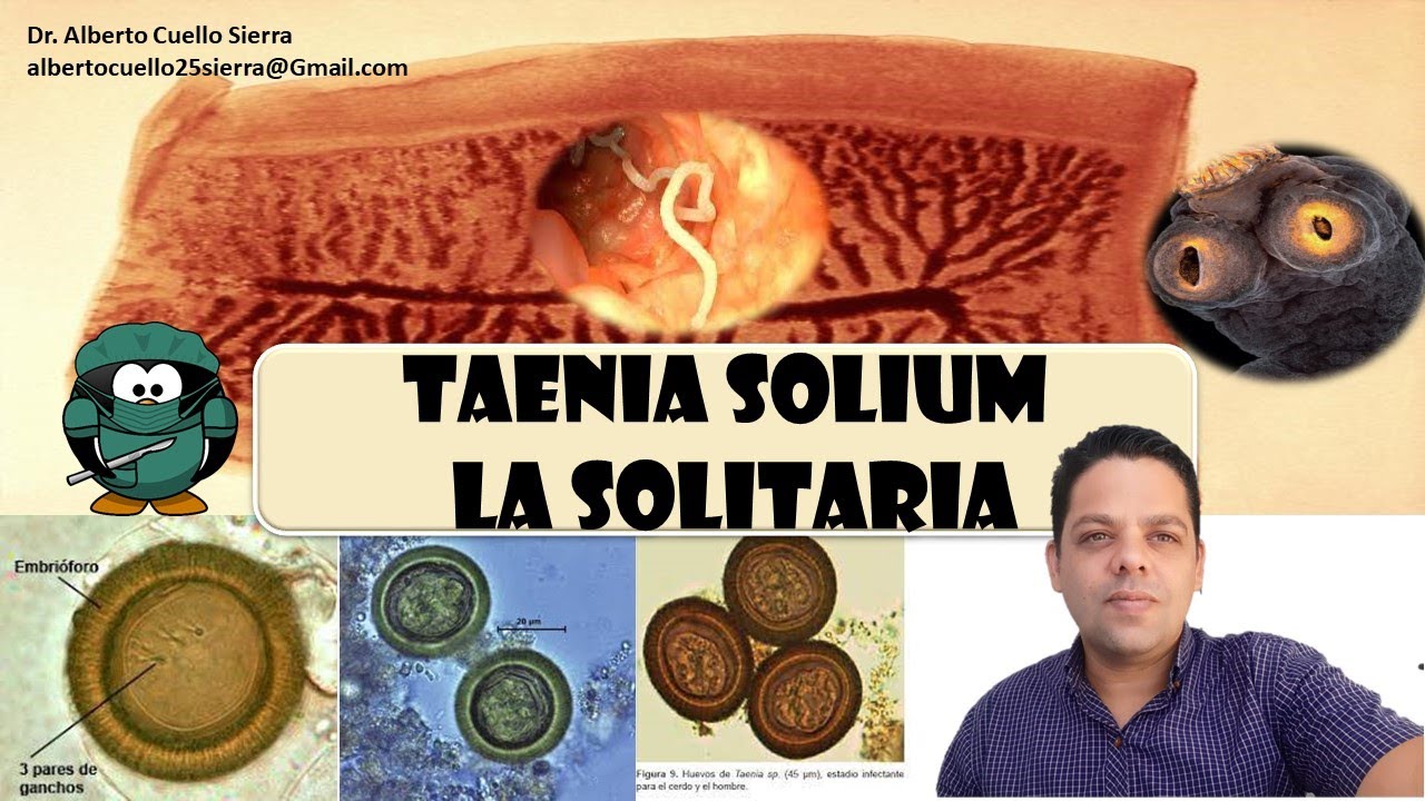 Taenia Solium. La solitaria (infeccion gastrointestinal) - YouTube