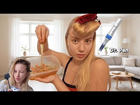 30 HARD CHALLENGE  PCOS 4 | Evde ağda, Dermapen, Bakım, Sohbet