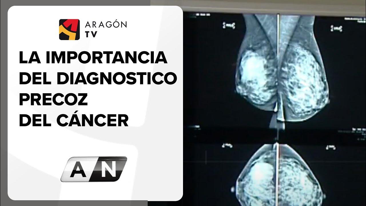 La importancia del diagnostico precoz del cáncer - YouTube