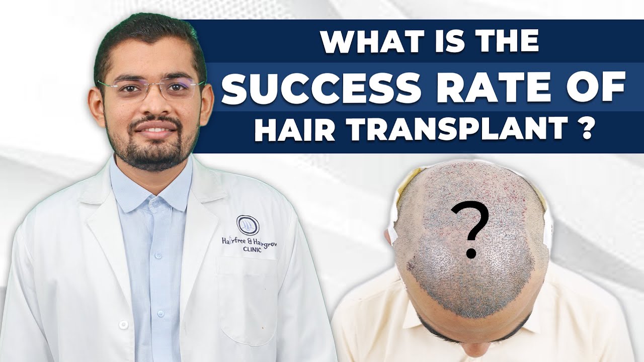 What is the success rate of transplanted hair? || % of Success Hair ...