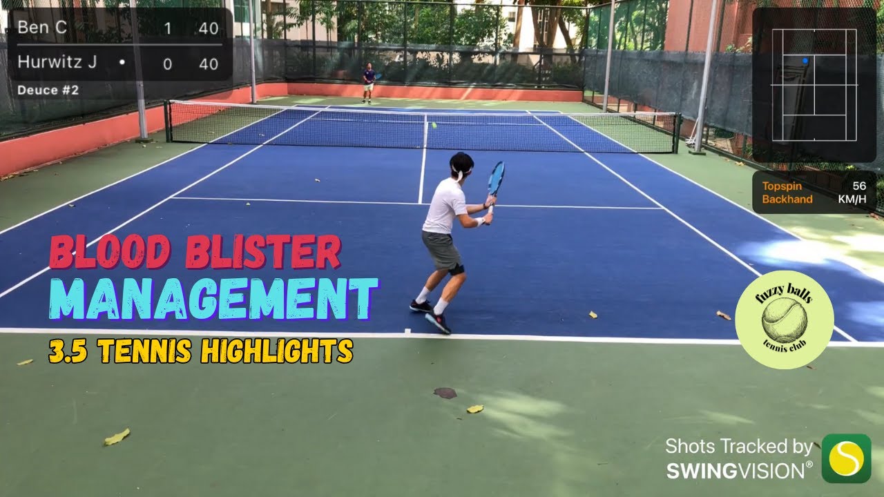 3.5 tennis: Blood blister management - YouTube