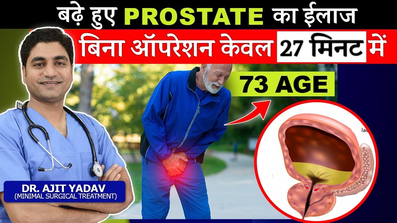 Enlarged Prostate or Benign Prostatic Hyperplasia BPH Treatment Without ...
