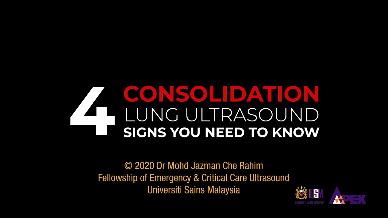 4 Consolidation Lung Ultrasound Signs You Need To Know - YouTube