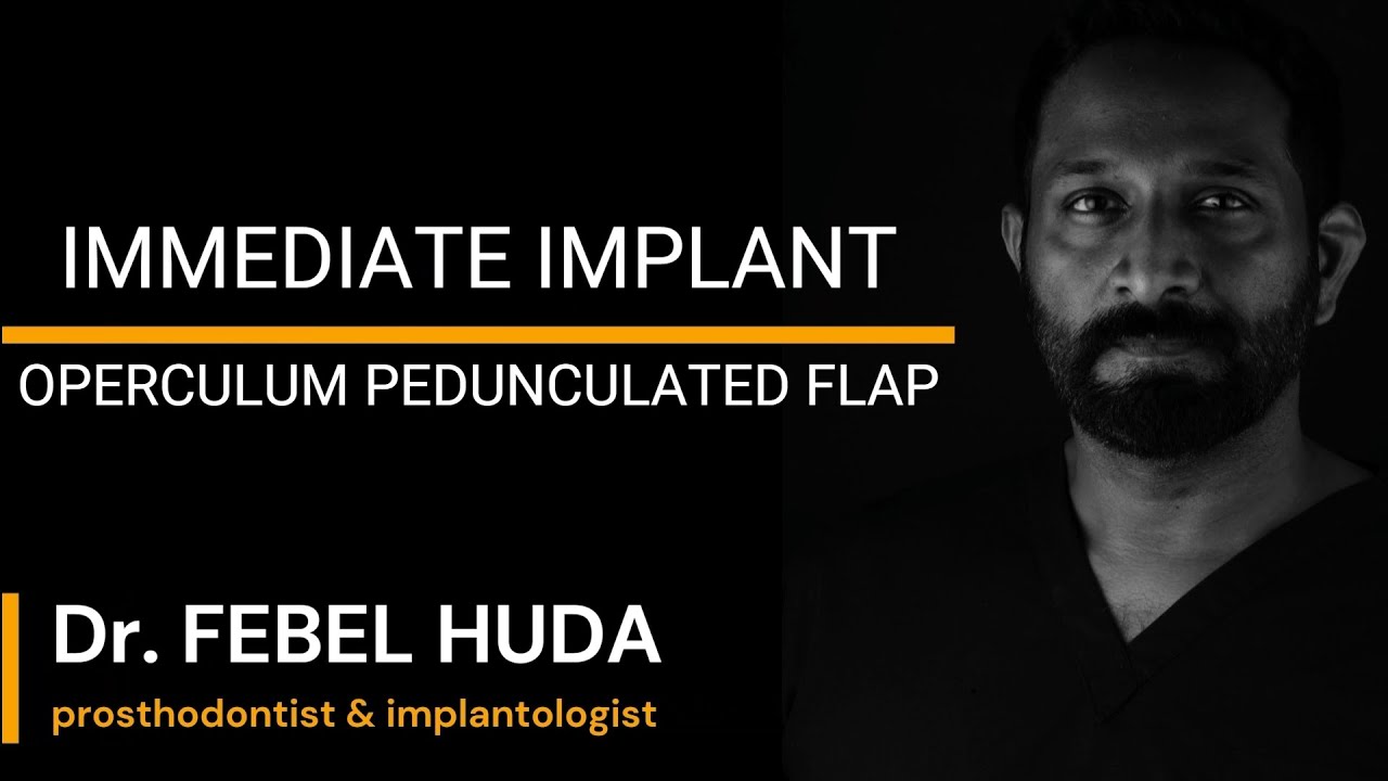 OPERCULUM PEDUNCLATED FLAP USED FOR PRIMARY CLOSURE OF IMMEDIATE ...