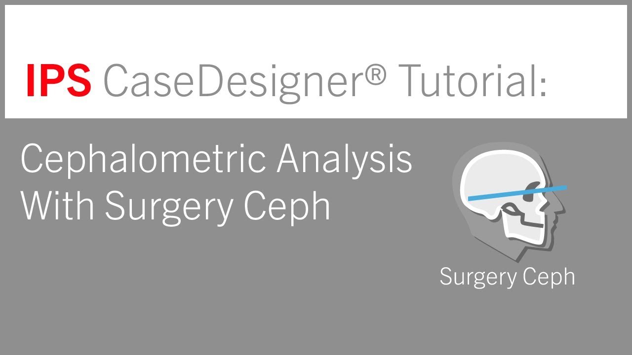 Cephalometric Analysis With Surgery Ceph | IPS CaseDesigner® Tutorial ...
