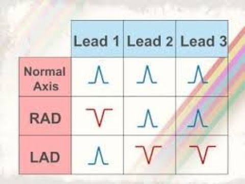Understanding and localization of leads in ECG - YouTube
