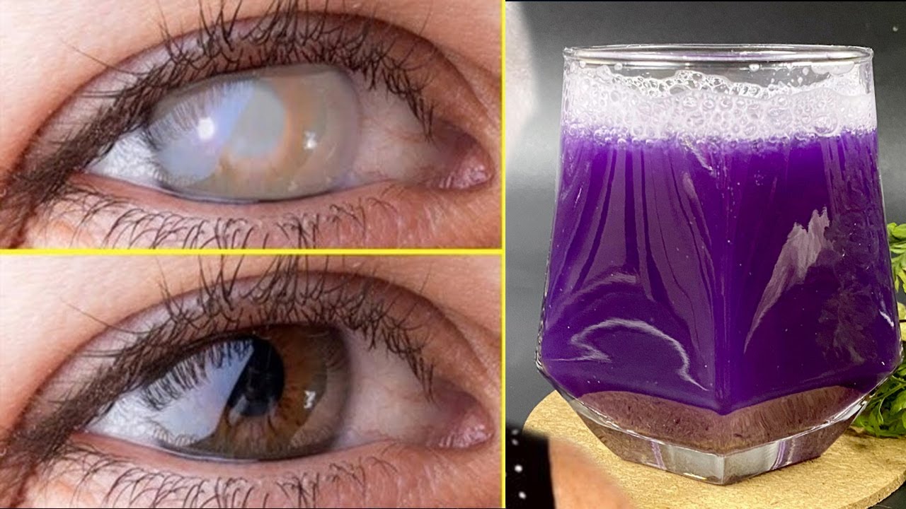 Seulement 1 Tasse Par Jour!! Améliorer Sa Vue Naturellement Et Obtenir ...