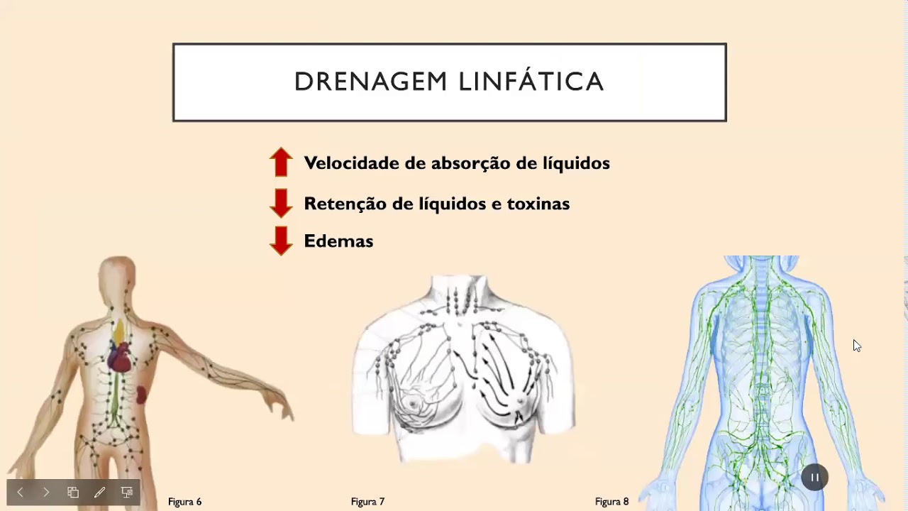 Tipos De Drenagem Linfática - NAZAEDU