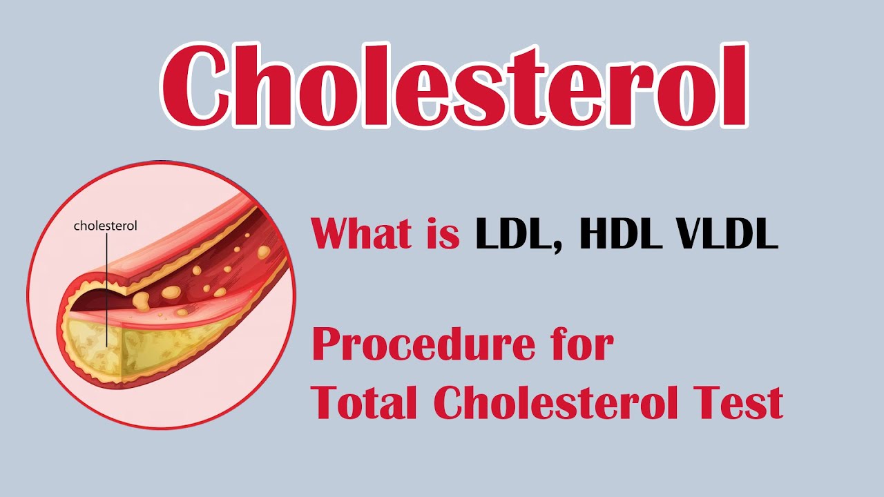 What is Cholesterol- Types LDL, HDL, VLDL | Sources | Ganesh Diagnostic ...