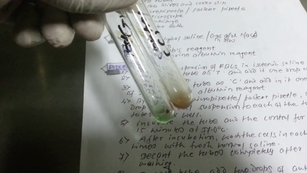 Du Test Positive - YouTube