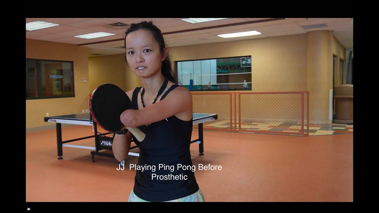 JJ Plays Ping Pong Before Prosthetic - YouTube