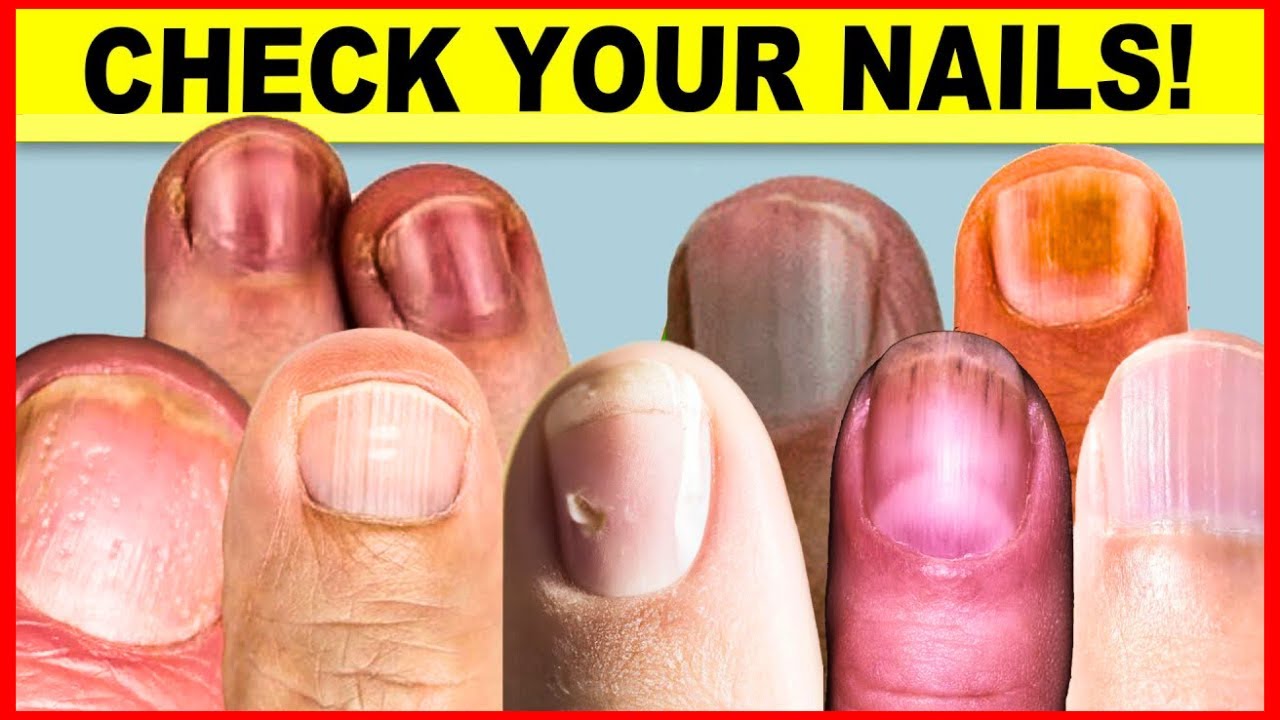 9 Things Your Nails Can Tell You About Your Health - YouTube