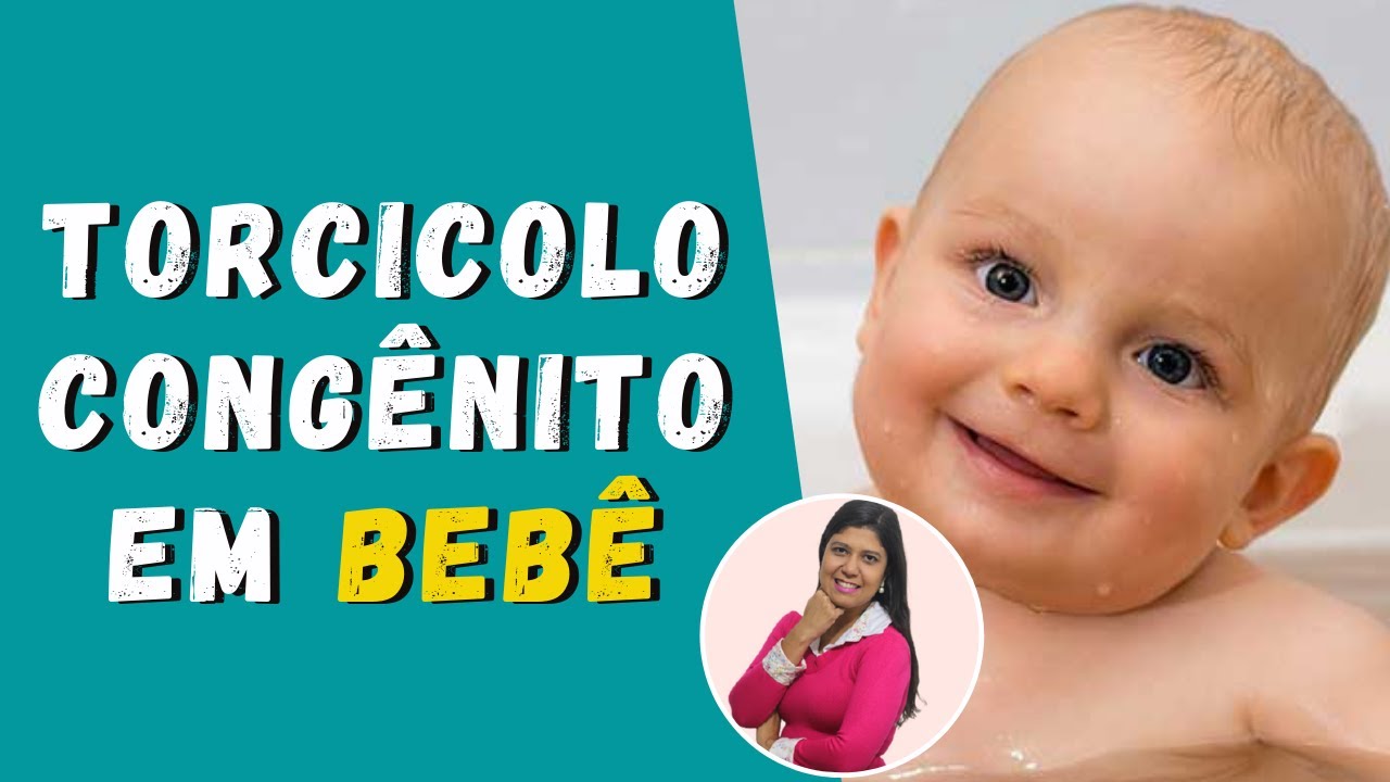 Torcicolo Congênito Como Dormir - RETOEDU