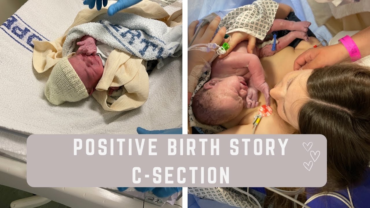 POSITIVE BIRTH STORY | ELECTIVE C-SECTION | LABOUR - YouTube