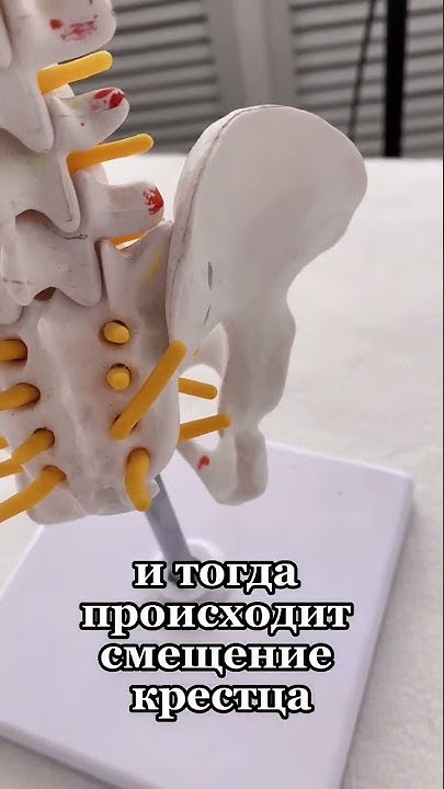 Сидячий образ жизни как он влияет на грыжи и протрузии Massage