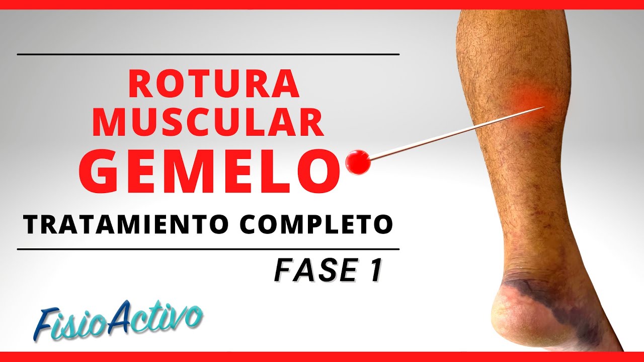 ROTURA MUSCULAR DE GEMELO 🦵🏼💥 Valoración y Tratamiento Completo ...