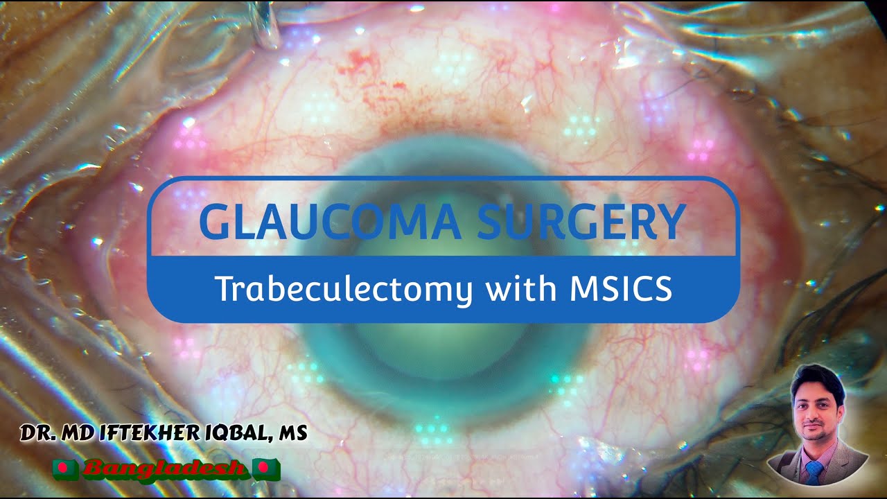 MIIQ 109: Glaucoma Surgery | MSICS-Trabeculectomy with @SonyXperia | DR ...