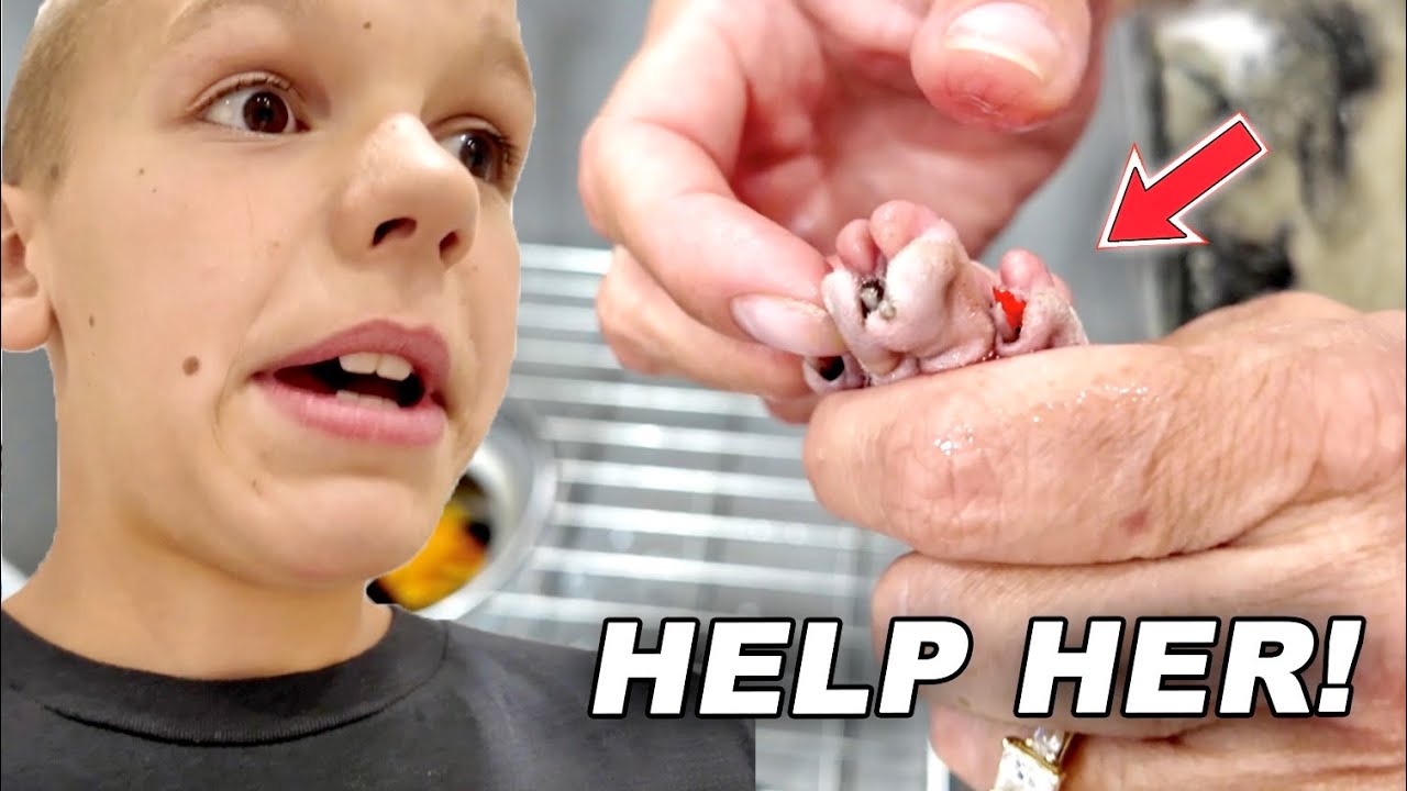 Her Nail SPLIT In Half!! - YouTube