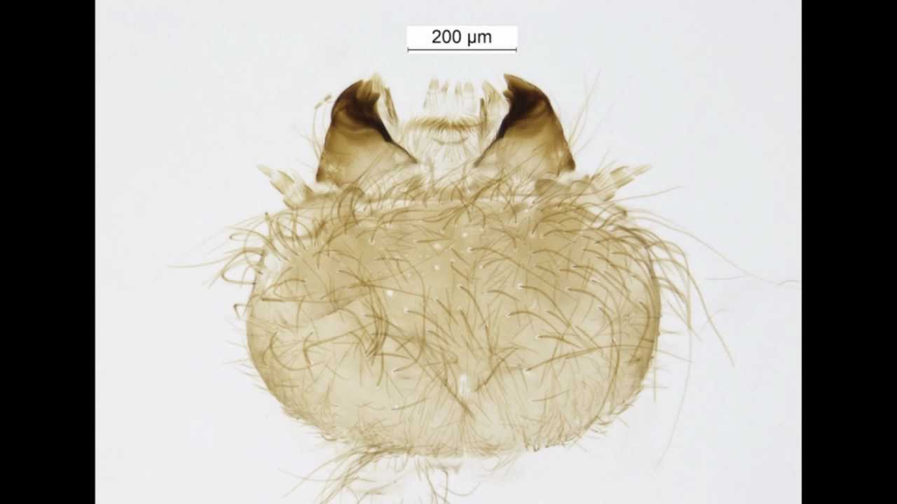 Trogoderma (Dermestidae) Larvae Dissection - YouTube