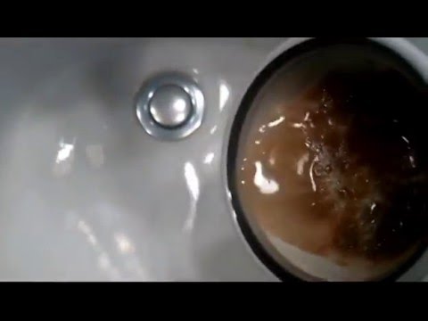 Cup Of Pneumonia. Pouring Out Cup Of Mucus I Coughed Up. Gross Video ...