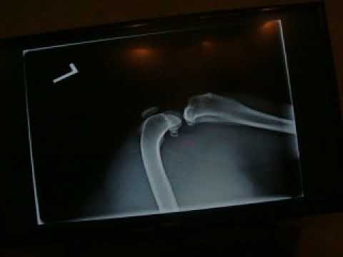 Zeke the Service Dog's OFA X-Rays Video of CD Images - YouTube