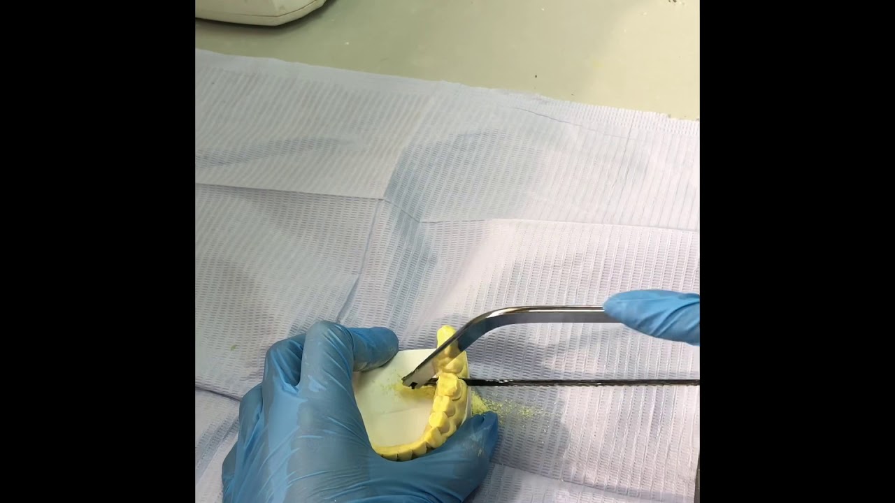 Die Splitting and Die Ditching | Yara Baassiri - YouTube