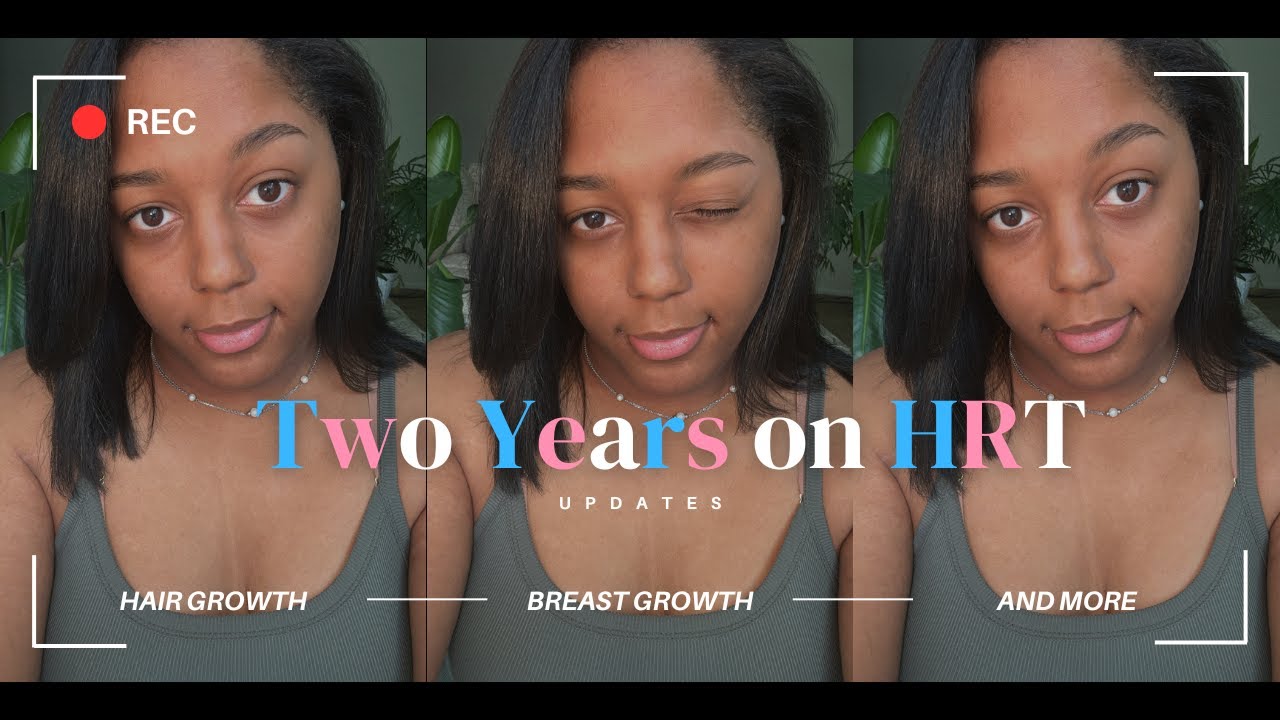 Two years on HRT MTF Pros and Cons I Breast Growth, Hair Growth and ...