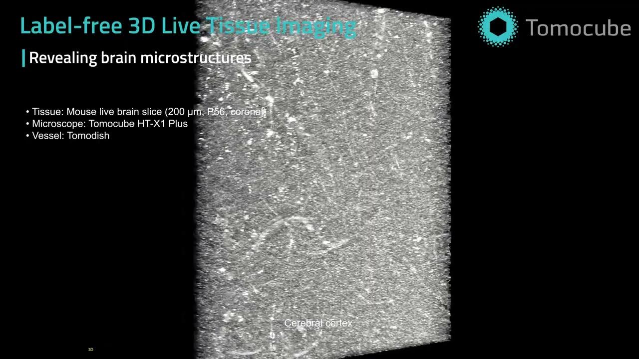 Brain Microstructures - Label-free 3D Live Tissue Imaging - YouTube