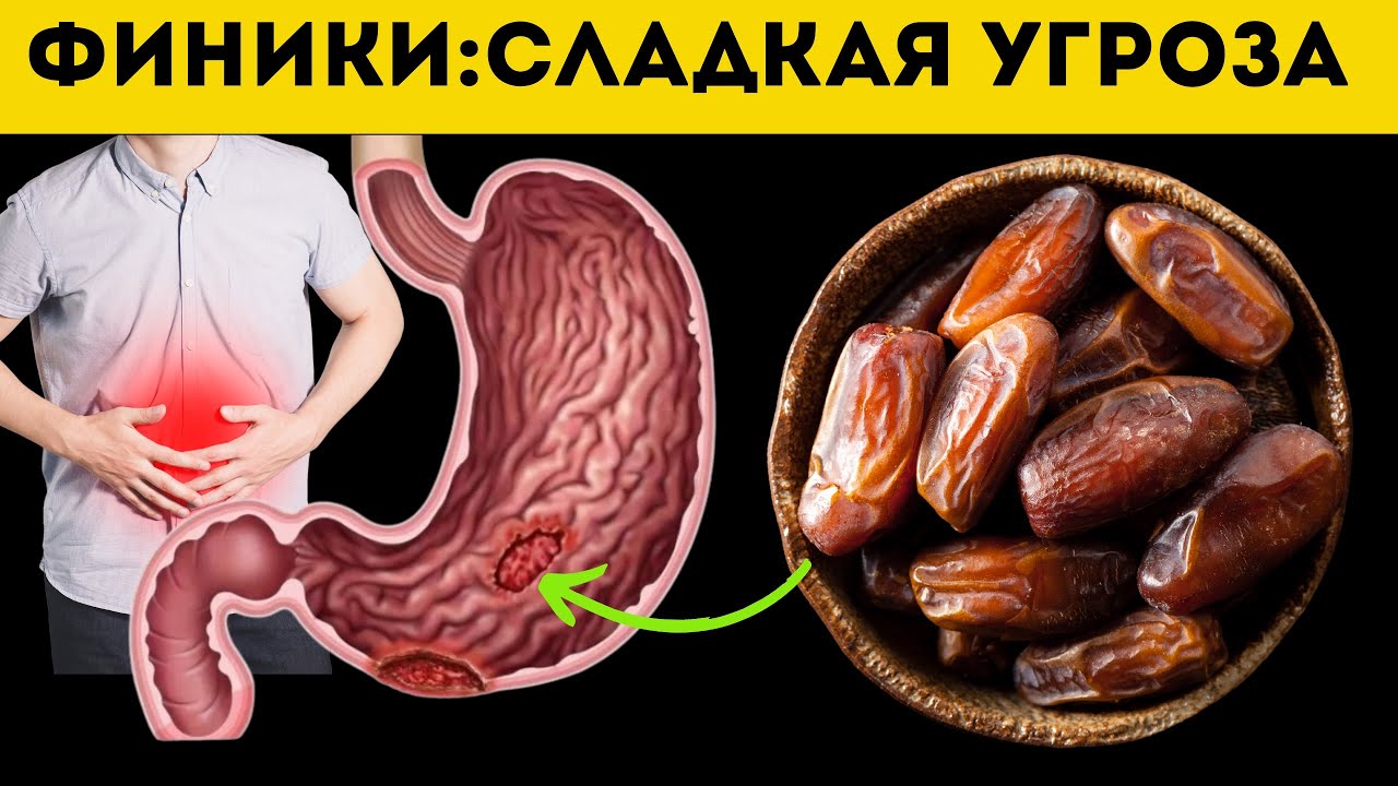 ДАЖЕ ОДИН ФИНИК СПОСОБЕН НА … Польза и вред для здоровья от фиников