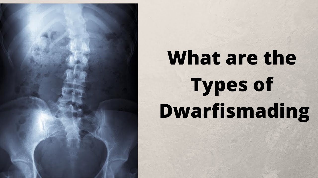 What are the Types of Dwarfism - YouTube