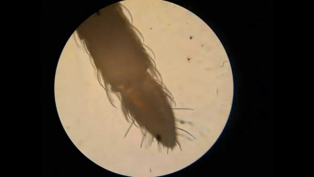 Mosquito under a microscope - YouTube