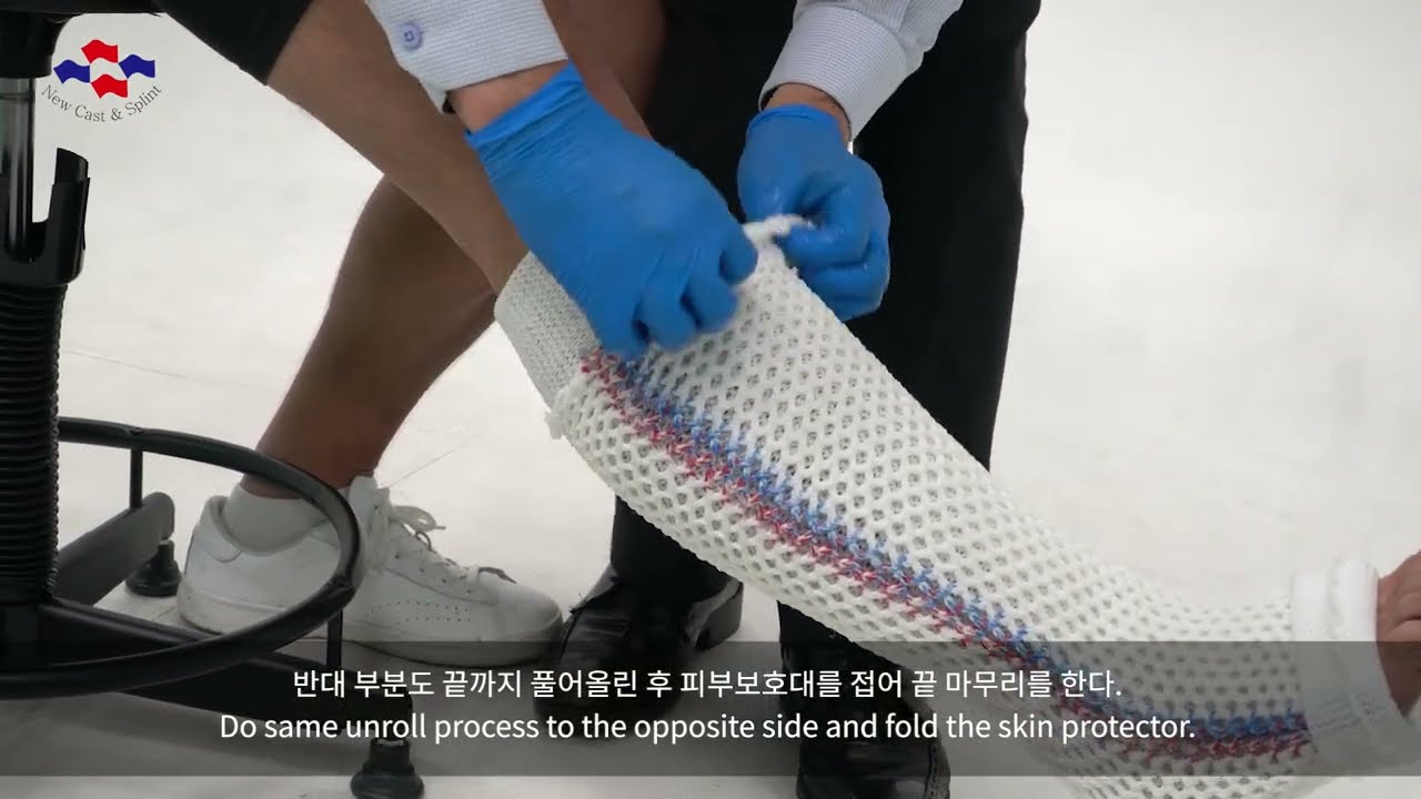 HM Cast Short Leg Procedure - YouTube