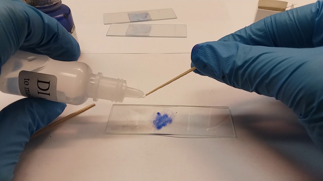 How to dye a cheek cell slide *Rebel Method - YouTube