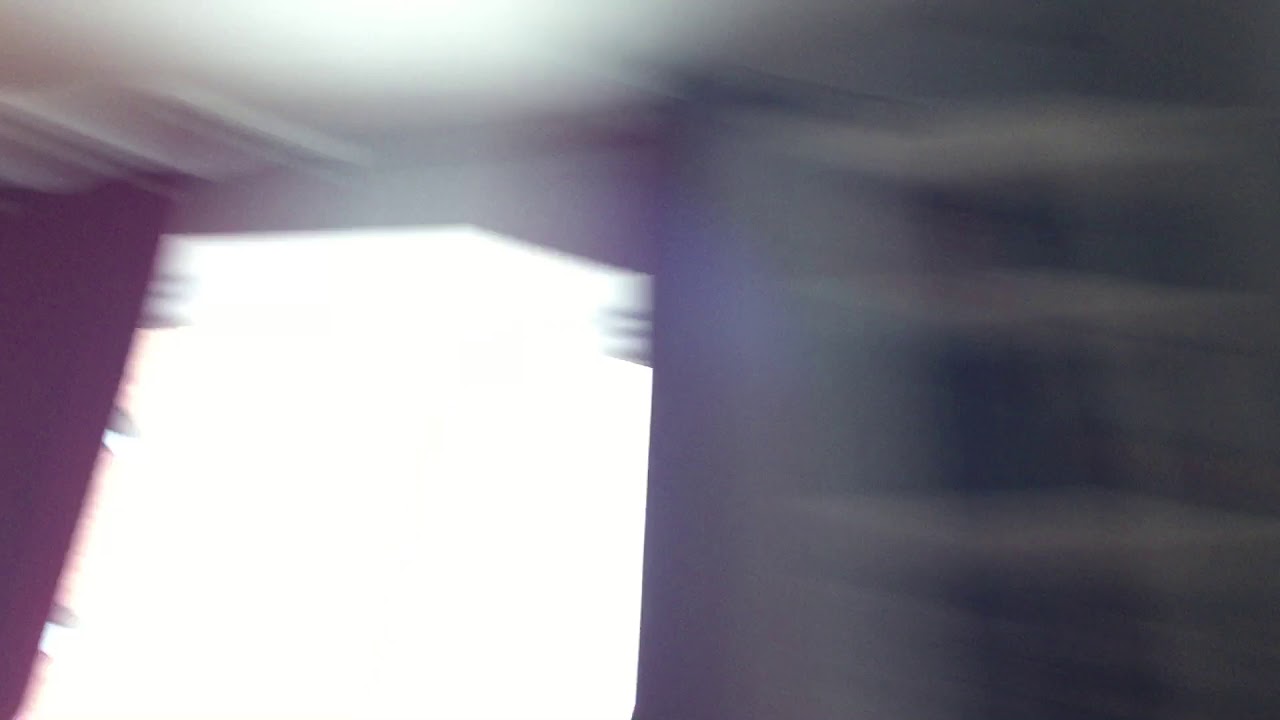 Apercu d'un vertige positionnel paroxystique bénin - YouTube