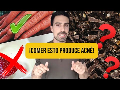 La MEJOR DIETA🥕 para el ACNÉ según especialista en DERMATOLOGÍA. ¡Que no te engañen con tu piel‼️
