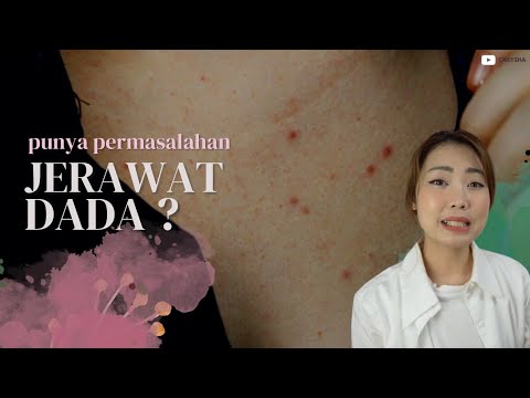 DADA JERAWATAN? Cobain tips ini untuk dada yang lebih mulus! 😍
