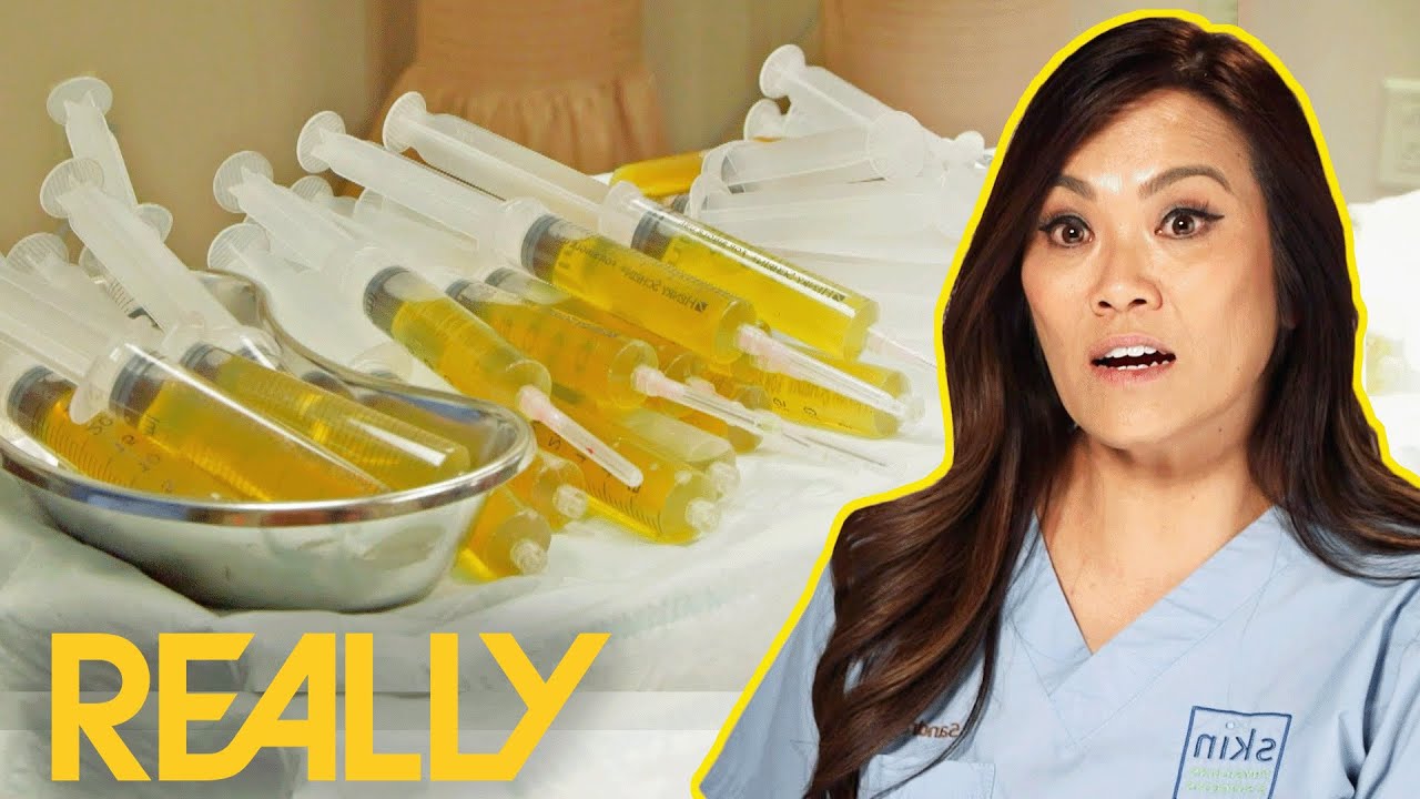Dr Lee Removes Almost A Litre Of Mysterious Fluid | Dr Pimple Popper ...