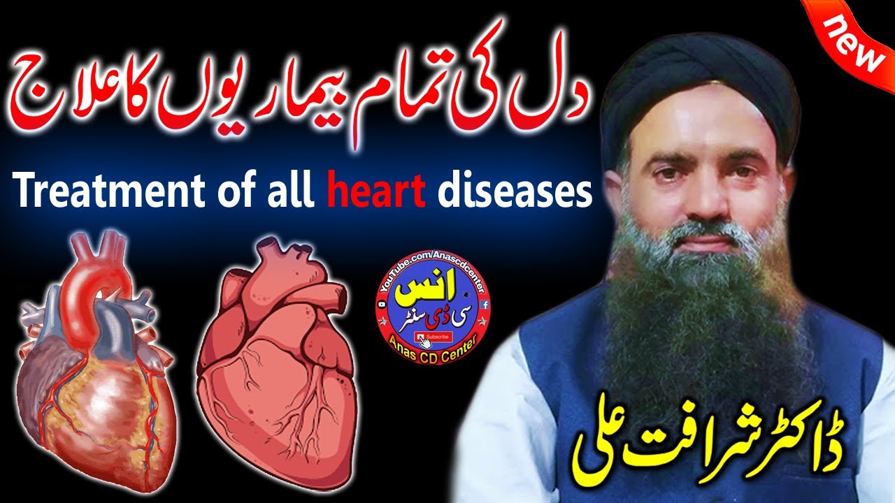 Treatment of All Heart Diseases By Dr Sharafat Ali | Anas CD Center ...