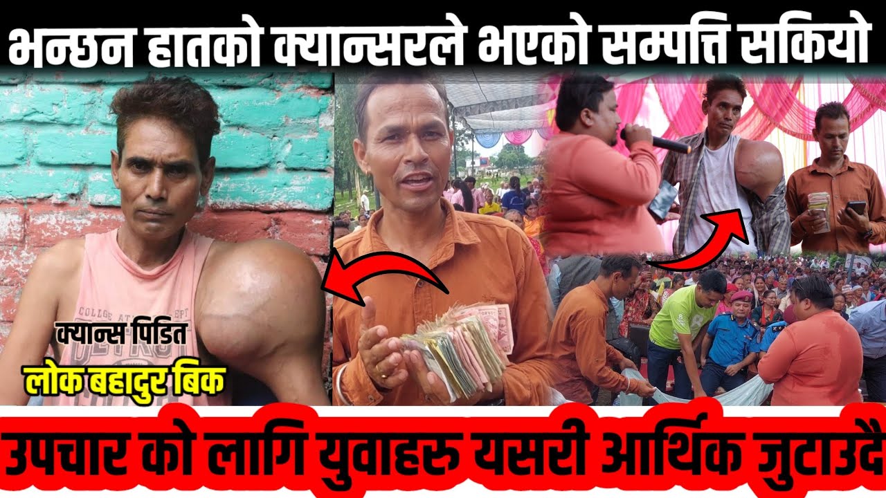 हातको क्यान्सर भएको लोक बहादुर बिकलाई डाक्टरले उपचार गरेपछी ठिक हुन्छ ...