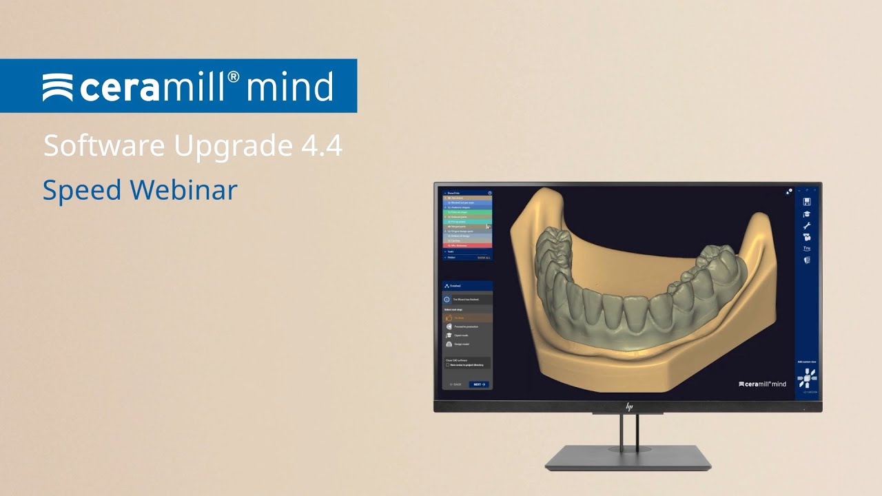 Ceramill Software Upgrade 4.4 - Speed Webinar - YouTube
