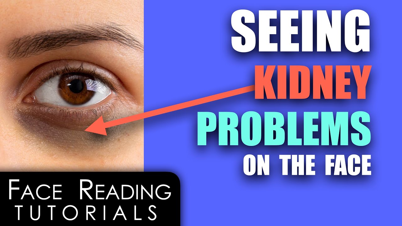 How To See Kidney Problems On The Face - YouTube